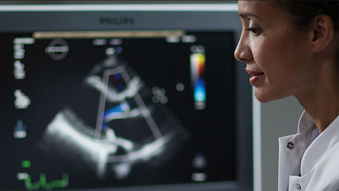 Coronariopatías | Philips