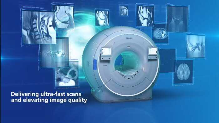 SmartSpeed de Philips - Aplicación clínica de RM | Philips Healthcare