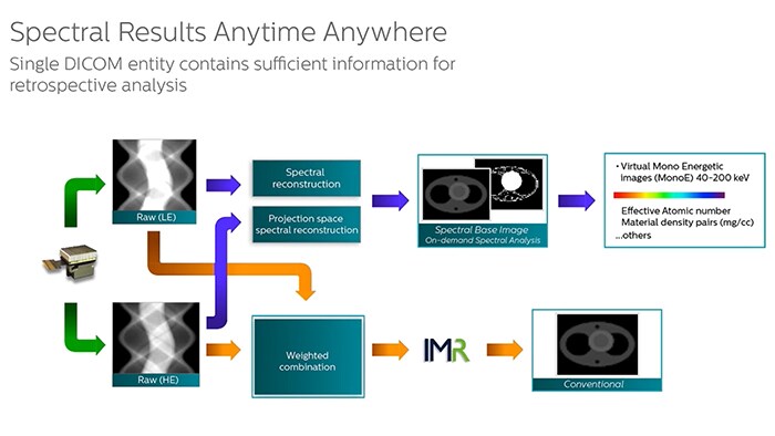 Spectral-detector CT l Philips Healthcare